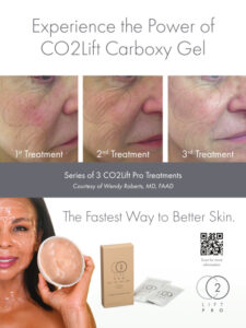 CO2 Lift Skin Rejuvenation - Lititz & Lancaster, PA - Iconic Medical Arts